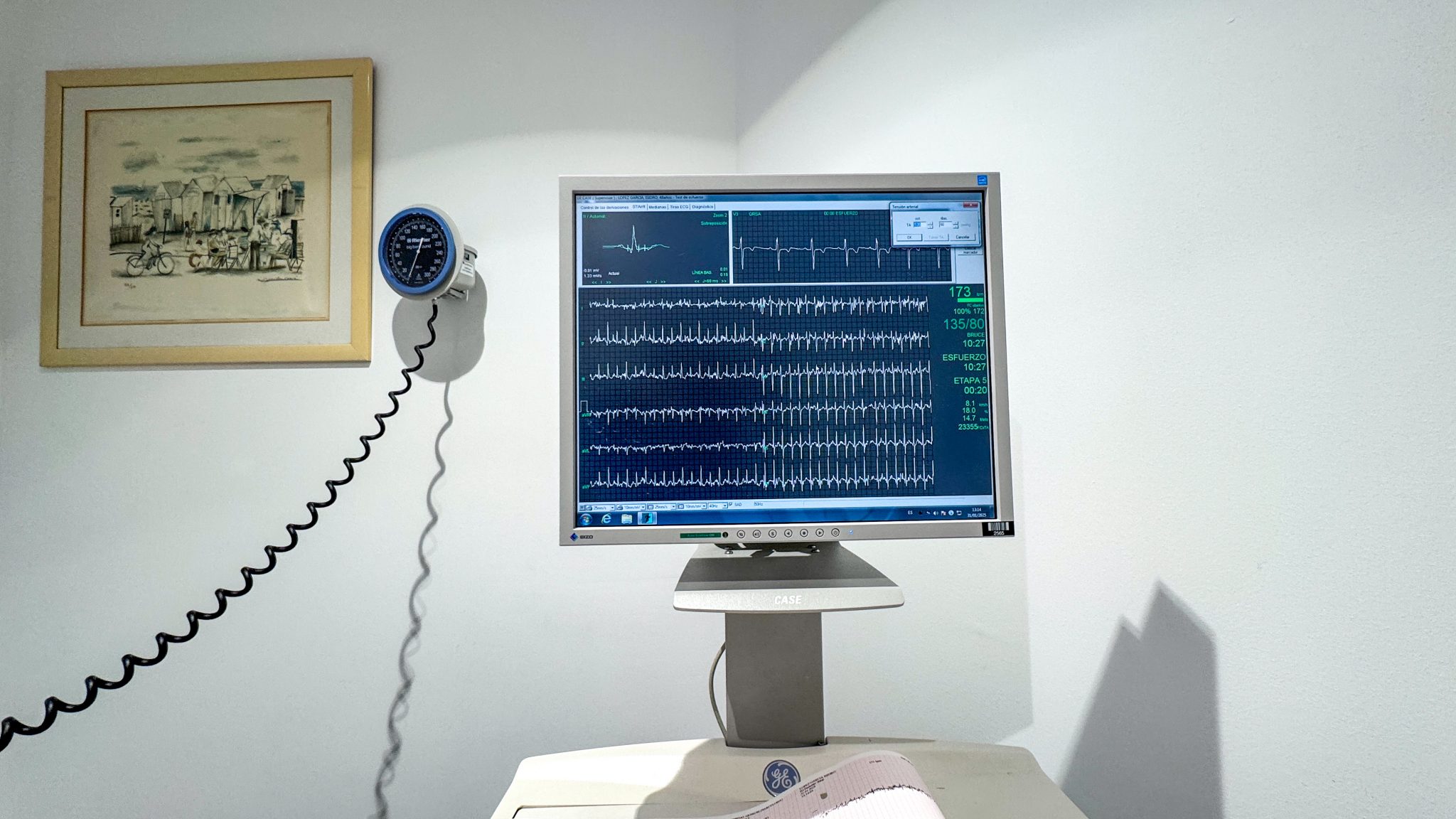 Así es una prueba de esfuerzo por el protocolo de Bruce - Corriendo Voy